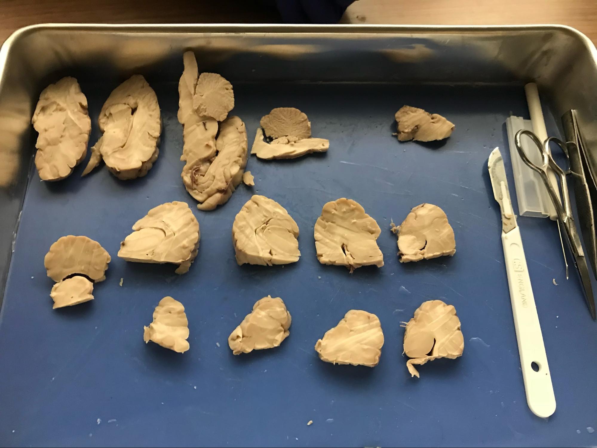 SfN Brain Dissection: Highlight Event – Research Rationalized